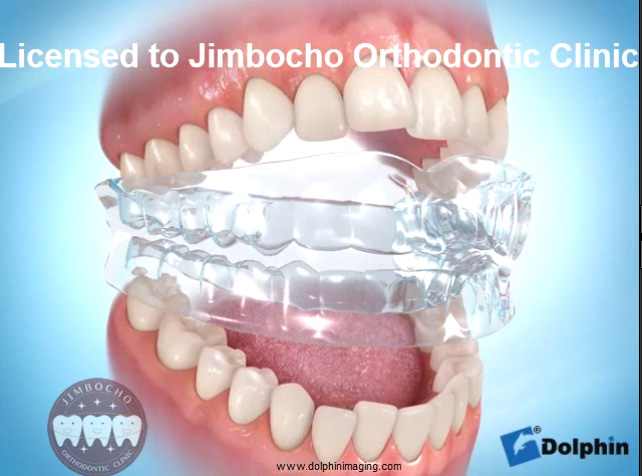 トゥースポジショナーtooth positioner、T.P.～様々な矯正装置～ | 東京都千代田区の矯正歯科専門医院 - 神保町矯正歯科クリニック